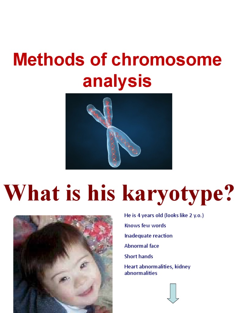 Human Chromosomes Analysis Eng | Download Free PDF | Karyotype ...
