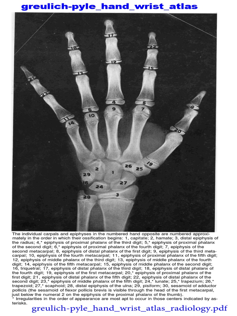 Greulich-Pyle Skeletal Age Atlas | PDF | Thumb | Skeletal System