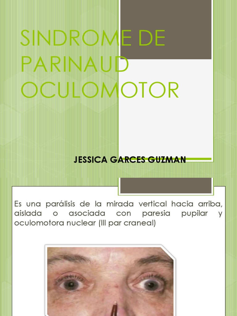 Sindrome de Parinaud Oculomotor | PDF | Enfermedades y trastornos ...