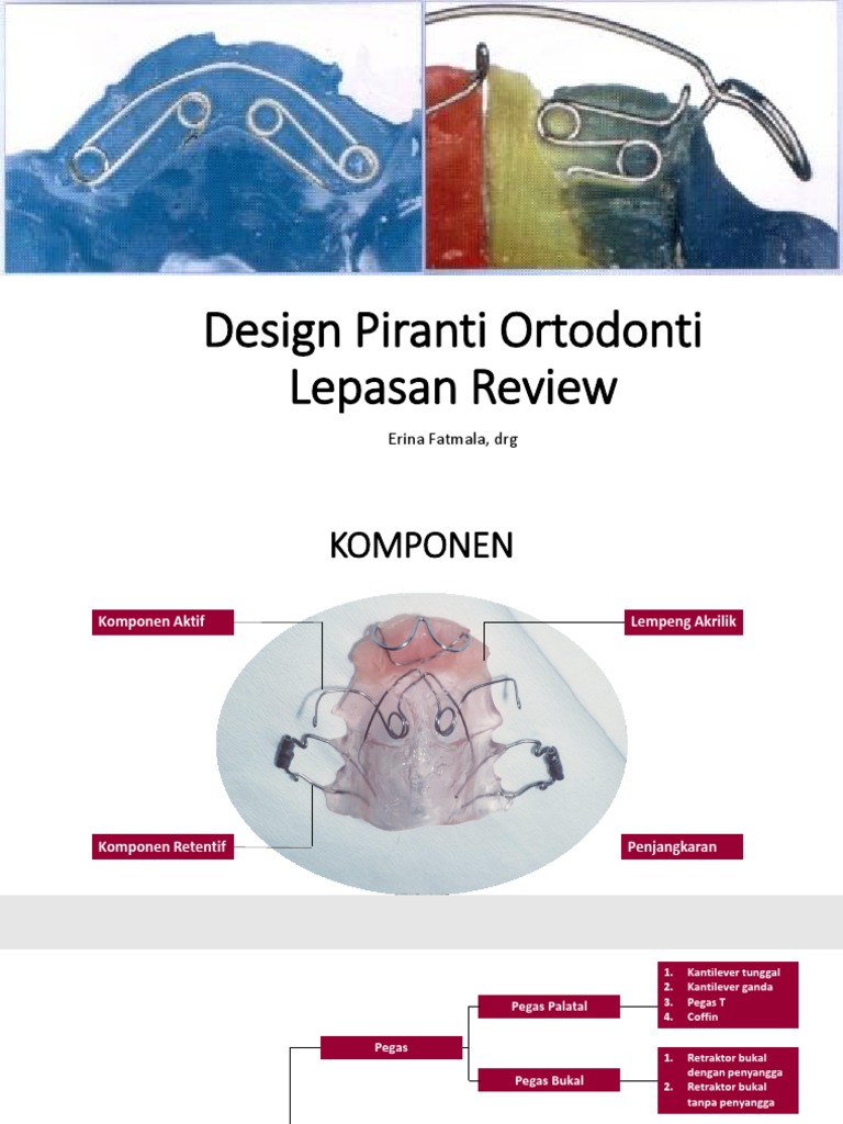 Design Piranti Ortodonti Lepasan Review-Erina Fatmala, DRG | PDF