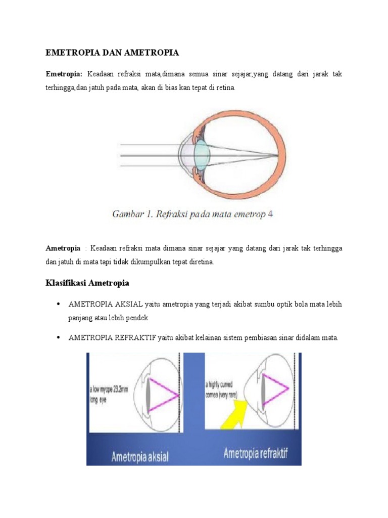 Emetropia Dan Ametropia | PDF | Kesehatan Holistik