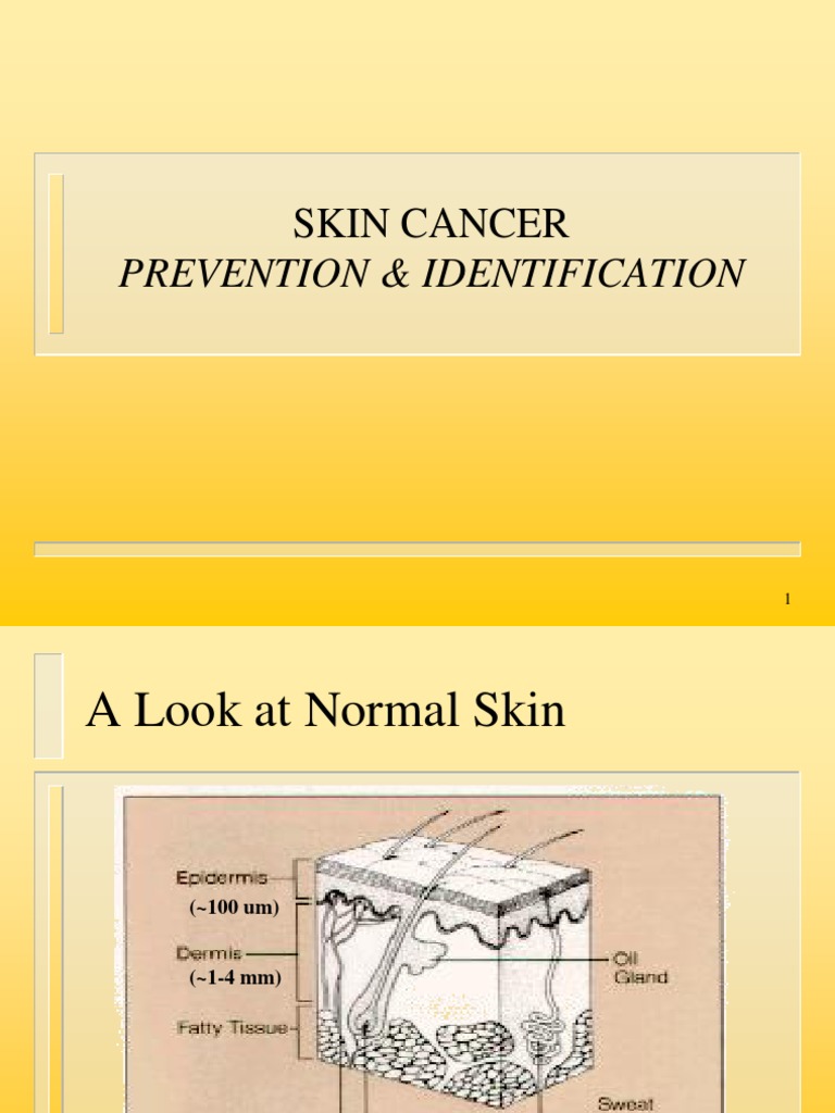 Prevention & Identification: Skin Cancer | PDF | Skin Cancer | Ultraviolet