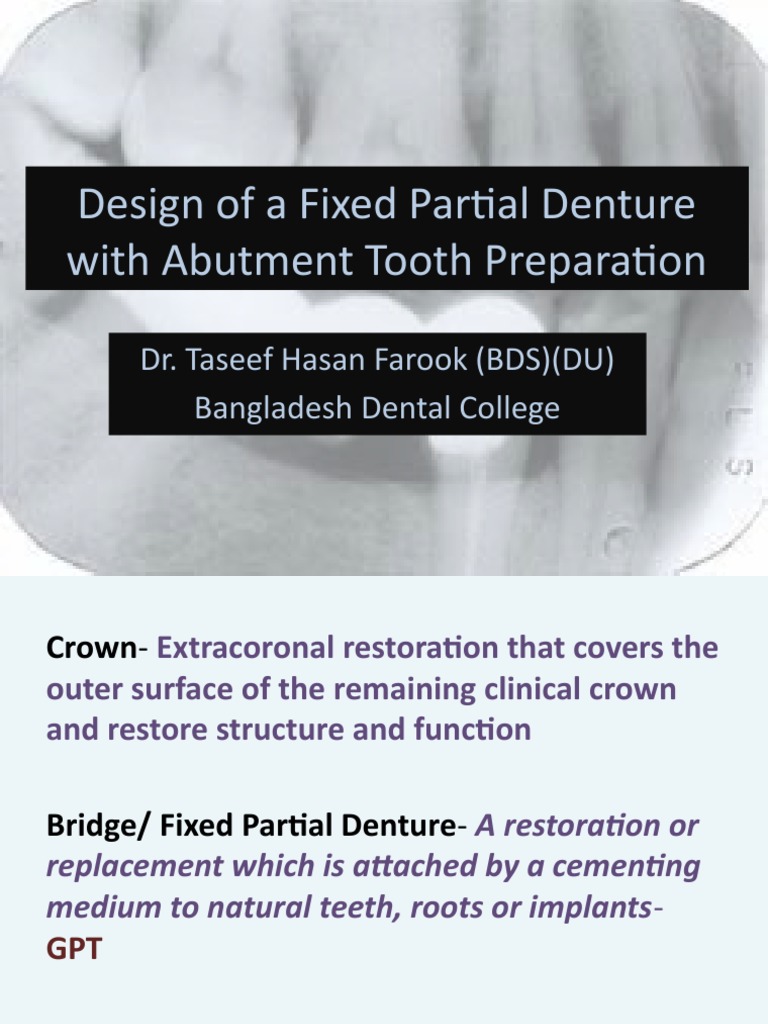 Design of A Fixed Partial Denture With Abutment Tooth Preparation | PDF ...