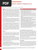 DVT Documentation: Acute vs Chronic Codes | PDF | Thrombosis | Vein