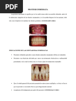 Líneas de Terminación | PDF | Dentadura postiza | Diente