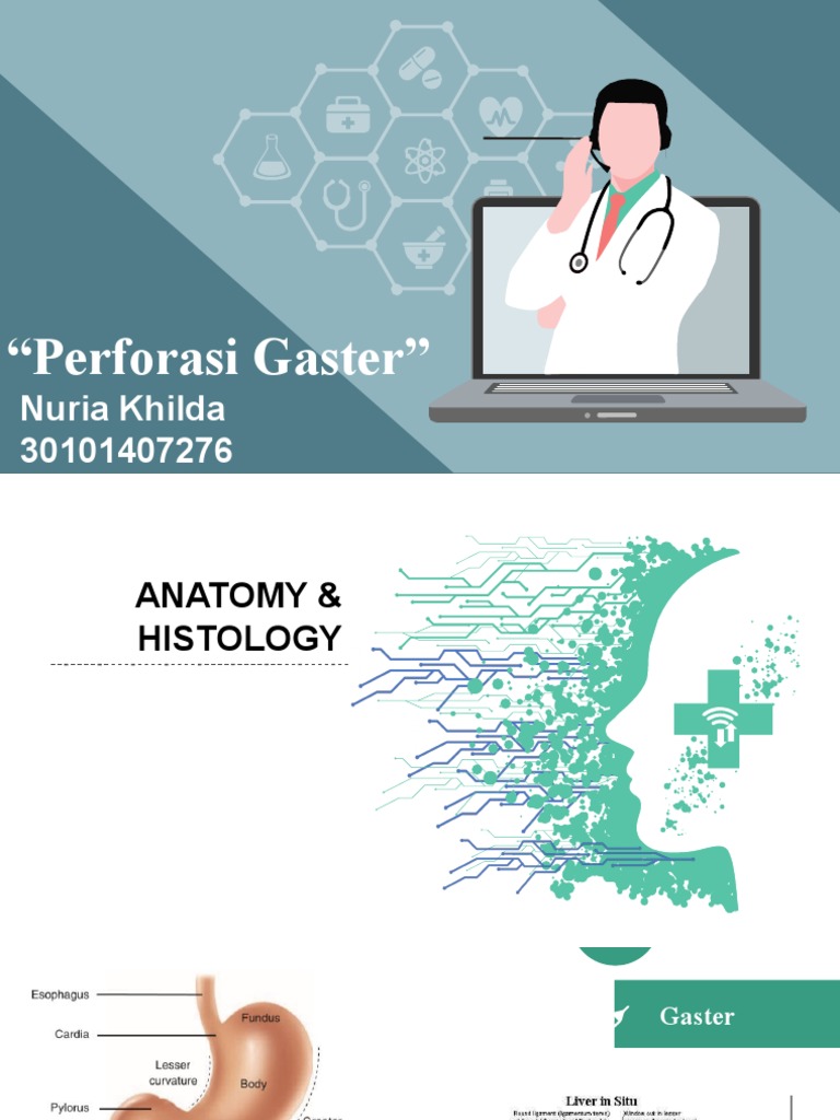 (NK) Perforasi Gaster | PDF | Stomach | Digestive System