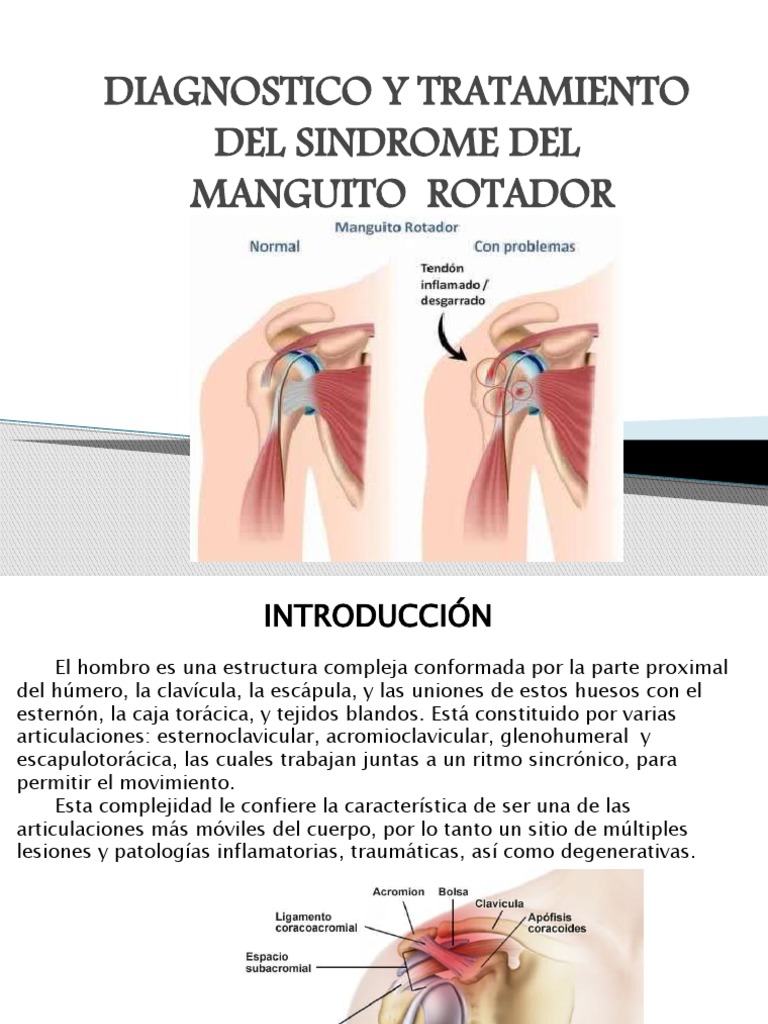 Diagnóstico y Tratamiento del Manguito Rotador | PDF | Hombro ...