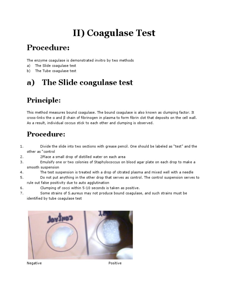 II) Coagulase Test: Procedure | PDF | Microbiology | Tissue (Biology)