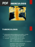Esquemas de Tratamiento para Tuberculosis | PDF | Tuberculosis ...