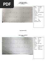 ECG Sample Report | PDF | Electrocardiography | Cardiology