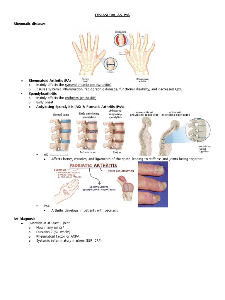 Disease: Ra, As, Psa Rheumatic Diseases | PDF | Rheumatoid Arthritis ...