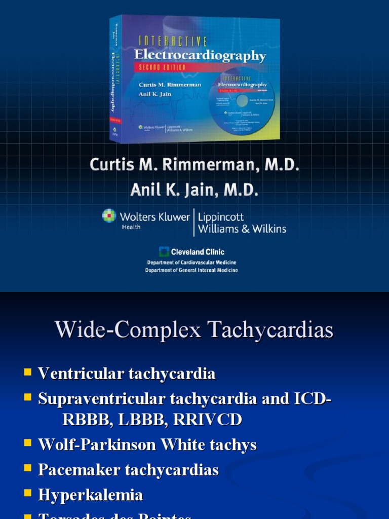 Wide Complex Tachycardia | PDF