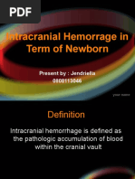 ICD-10 Codes for Subarachnoid Hemorrhage | PDF | Nervous System ...