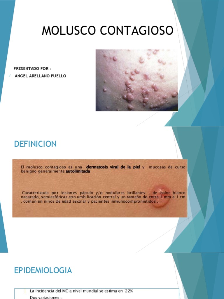 Molusco Contagioso | PDF | Bienestar