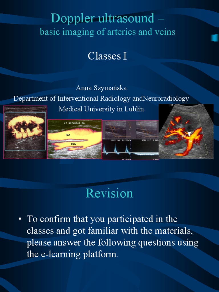Doppler Ultrasound Assignment | PDF