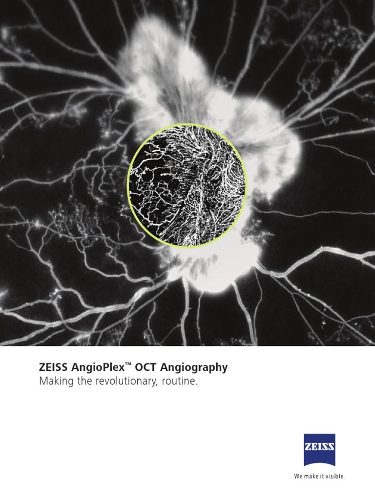 Angioplex Brochure Us 31 010 0018i | PDF | Retina | Vision