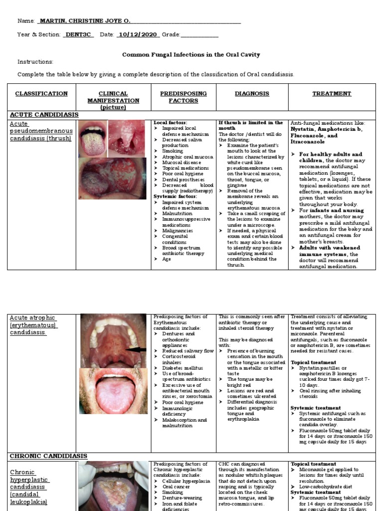 Chronic Hyperplastic Candidiasis