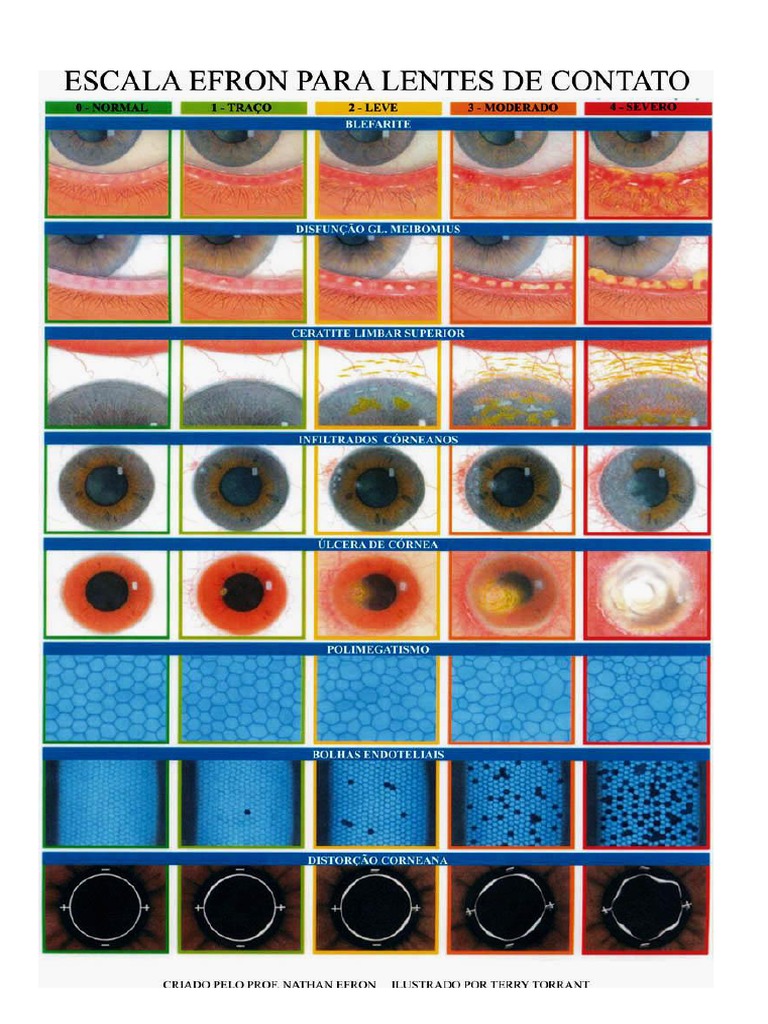 Escala Efron Lentes de Contato | PDF