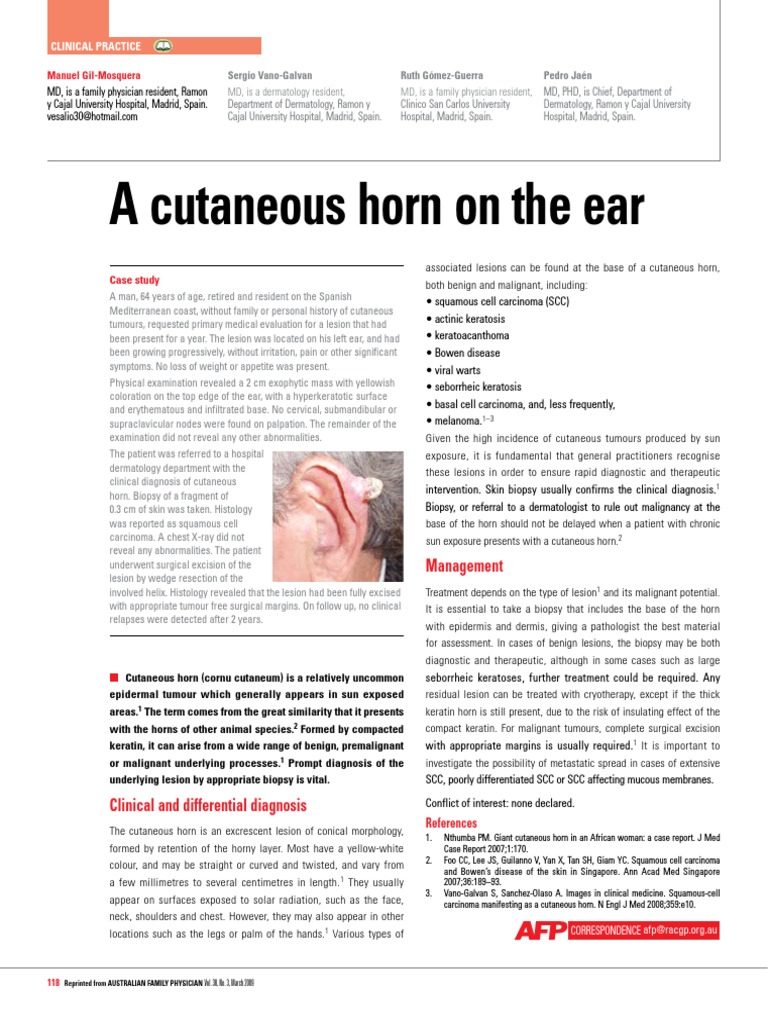A Cutaneous Horn On The Ear: Management | PDF | Biopsy | Neoplasms