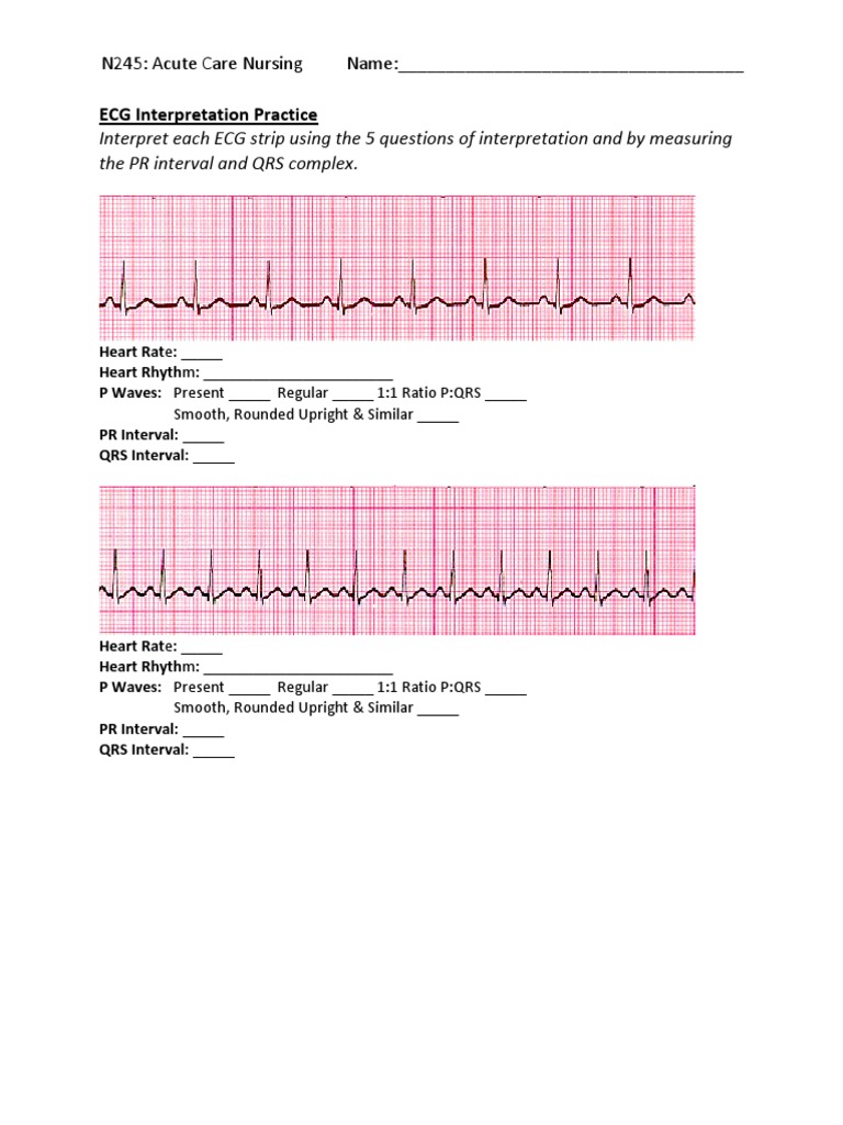 EKG Examples Of Interpretation Ekg Interpretation Cheat, 50% OFF