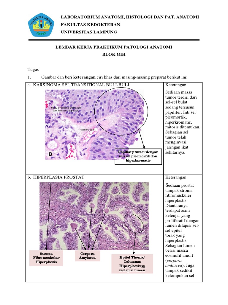 Alda Putri Rahmadilla (Laprak PA Blok GU) | PDF