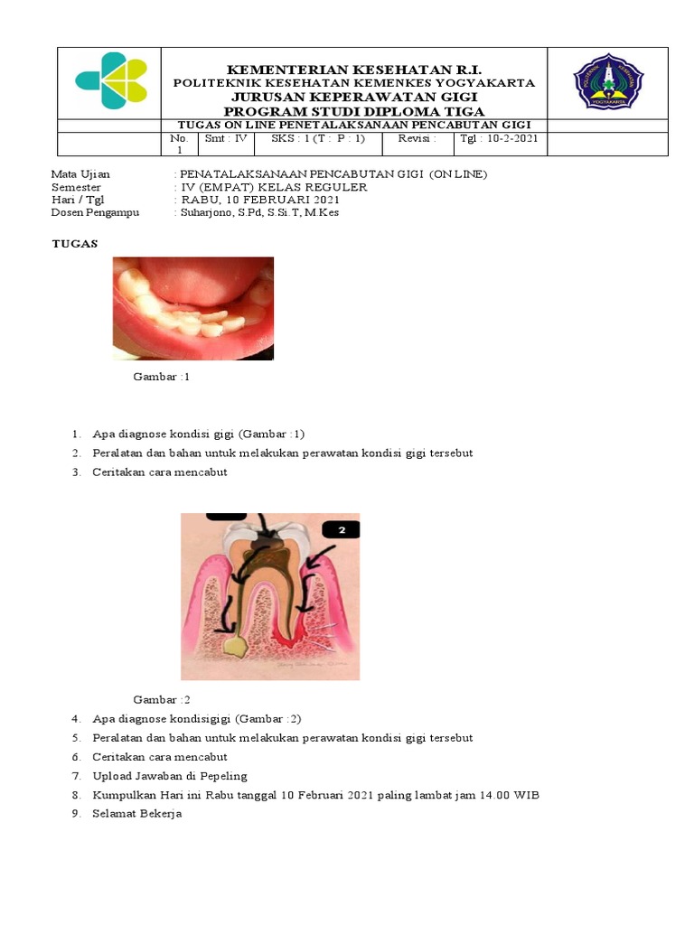 Soal Pencabutan Gigi | PDF