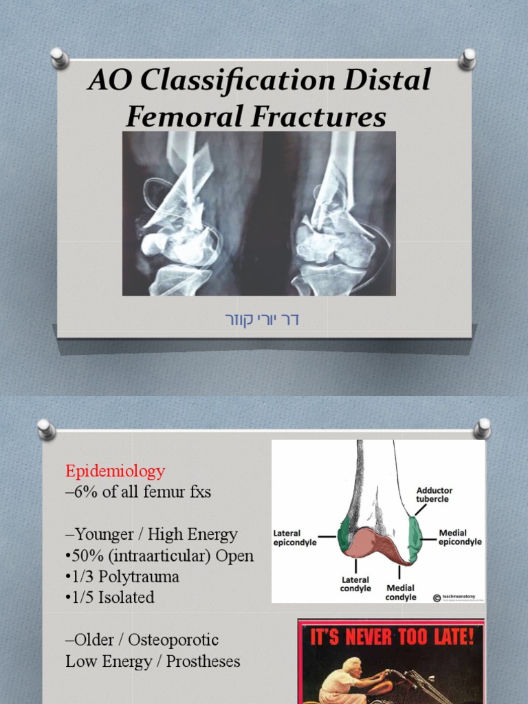 Distal Femur Fracture Classification
