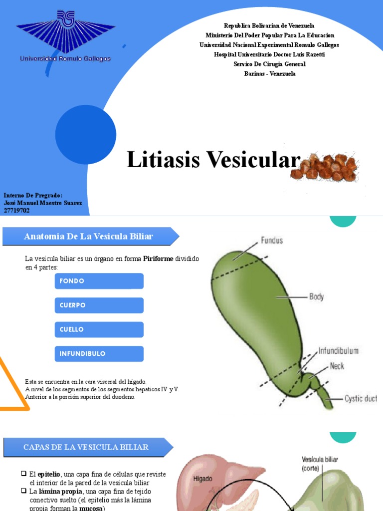 Litiasis Definitivo | PDF | Hígado | Bilis