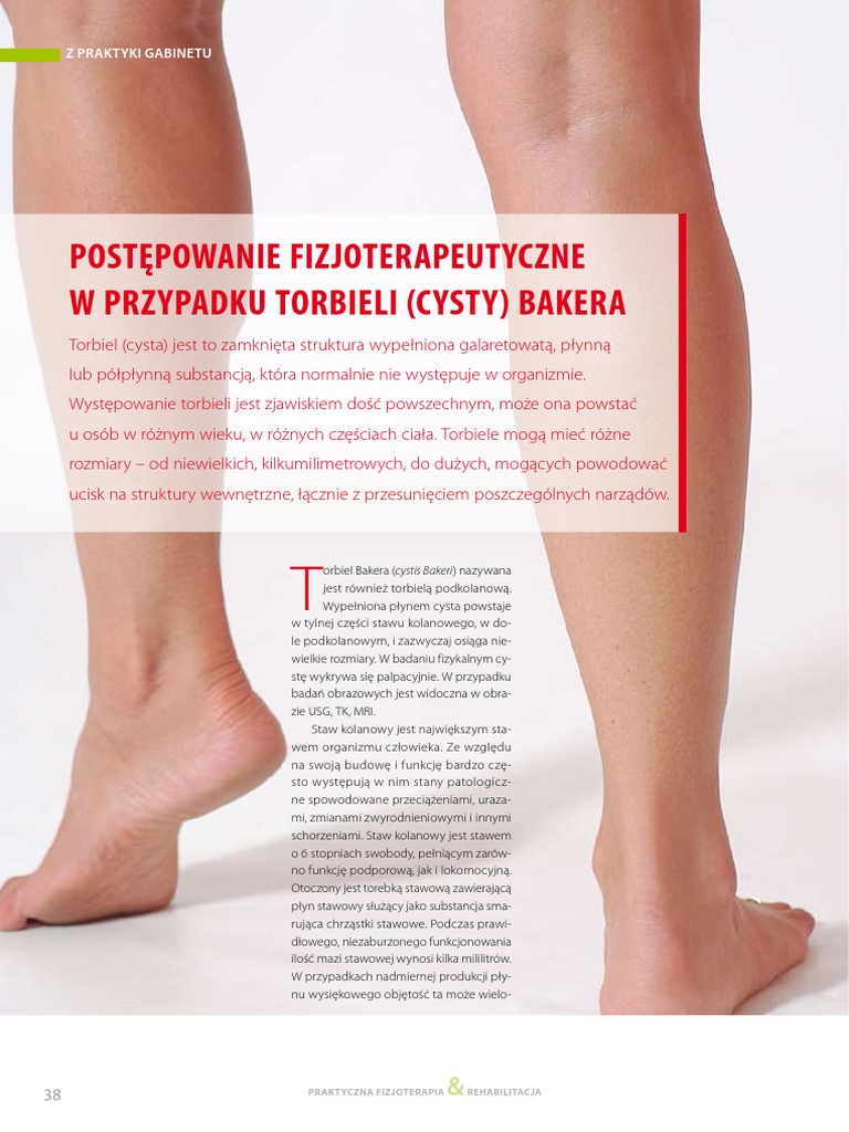 Postępowanie Fizjoterapeutyczne W Przypadku Torbieli (Cysty) Bakera | PDF