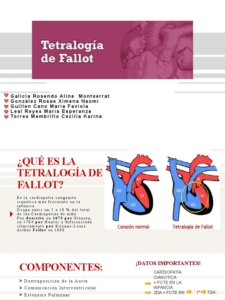 Tetralogía de Fallot | PDF | Desorden congenito | Medicina CLINICA