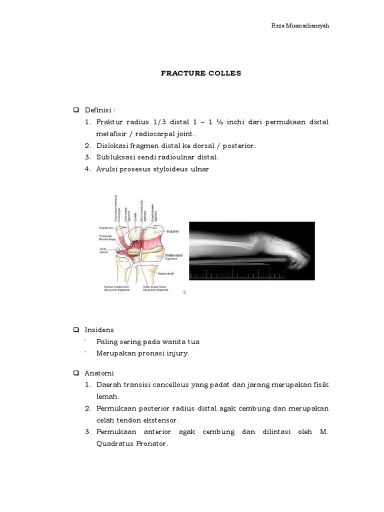 Fracture Colles | PDF