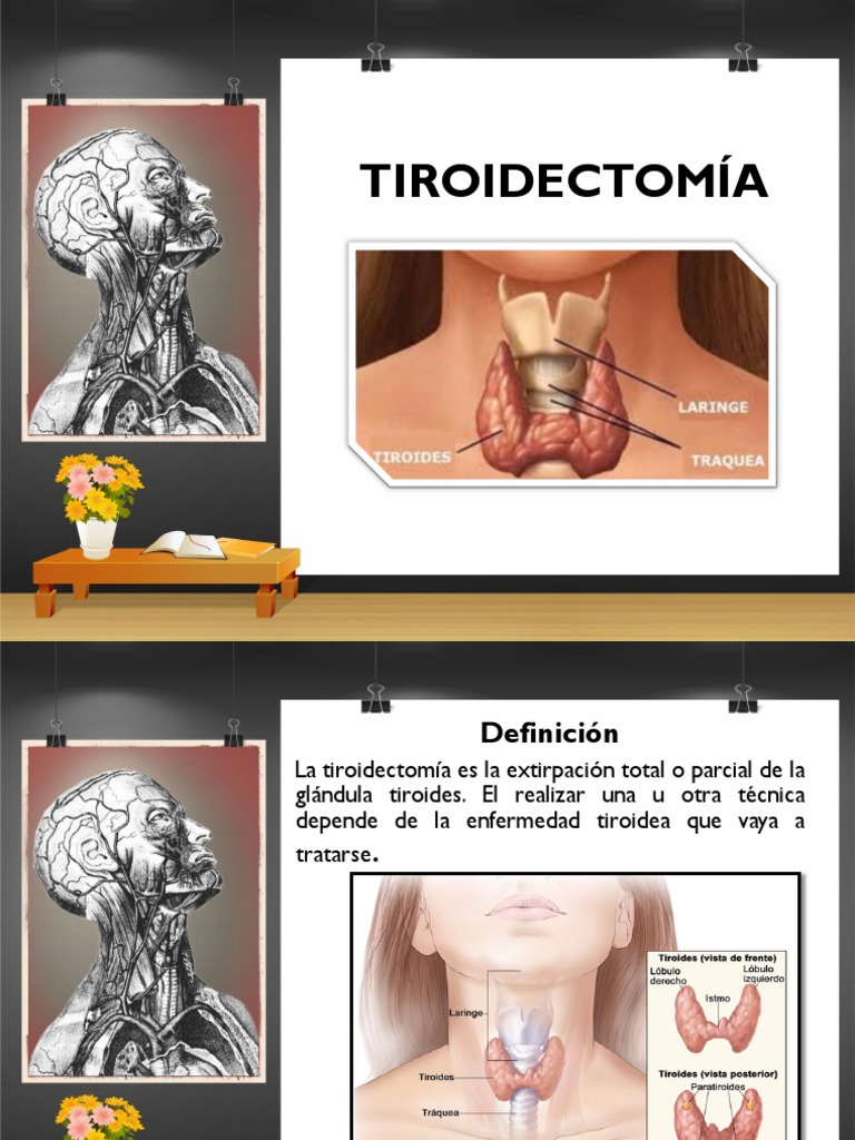 TIROIDECTOMIA | PDF | Tiroides | Sistema endocrino