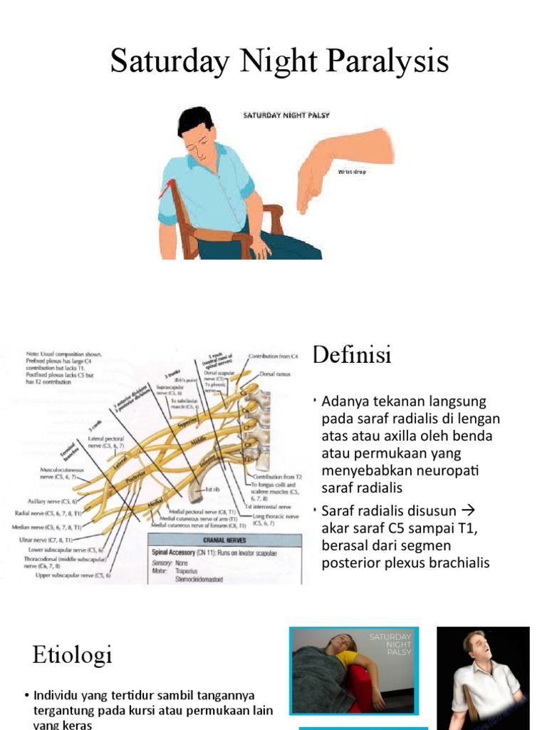 Saturday Night Paralysis | PDF