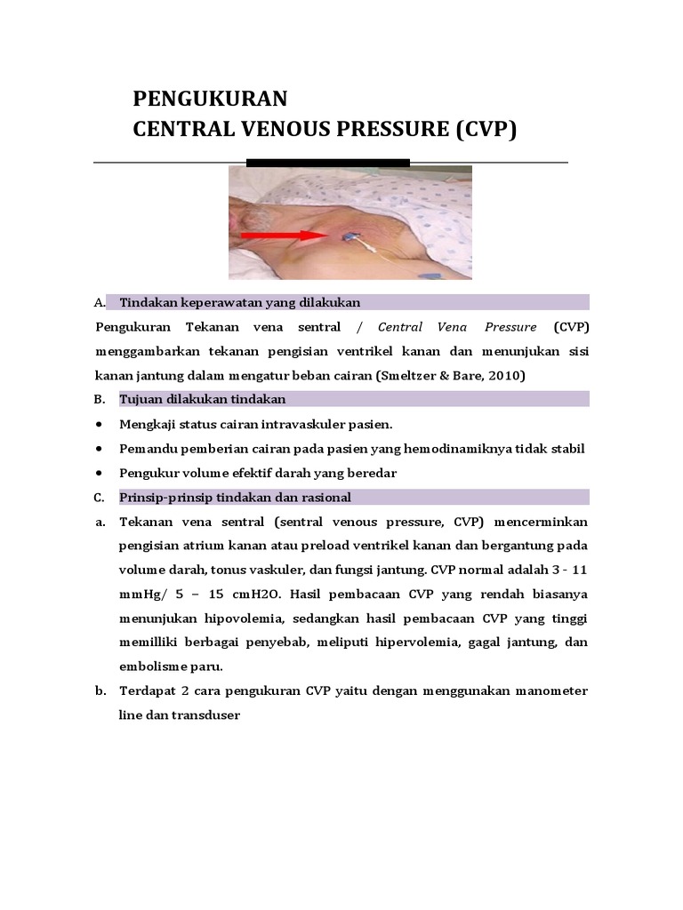 Pengukuran Central Venous Pressure (CVP) | PDF