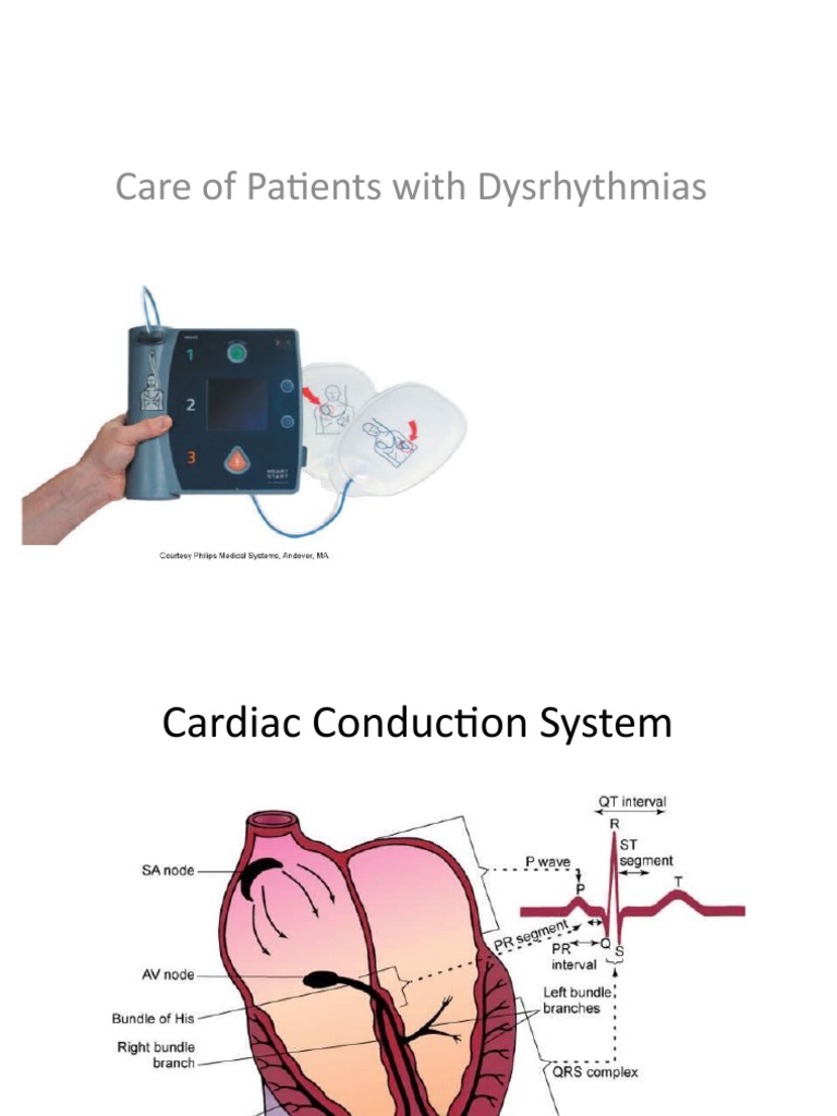 Care of Patients With Dysrhythmias | PDF | Electrocardiography | Heart