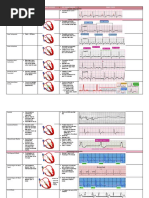 Basic EKG ECG Rhythms Cheatsheet | PDF | Electrocardiography | Cardiac ...