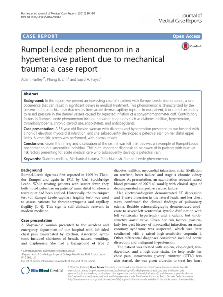 Rumpel-Leede Phenomenon in A Hypertensive Patient Due To Mechanical ...