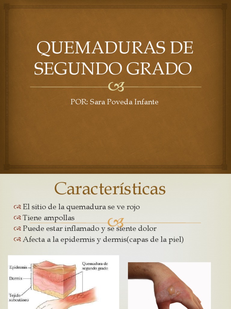 Quemaduras de Segundo Grado | PDF