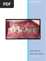 Clasificación de Winter | PDF | Ramas de Odontología | Boca