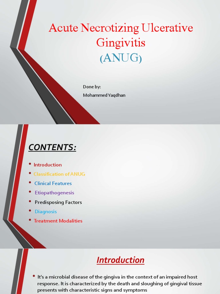 Acute Necrotizing Ulcerative Gingivitis: (ANUG) | PDF | Dentistry Branches | Health Care