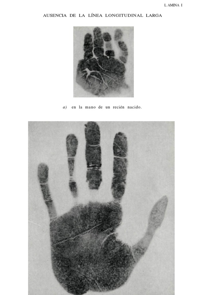 Análisis de la Línea Simiesca en Manos | PDF | Mano | Extremidades ...
