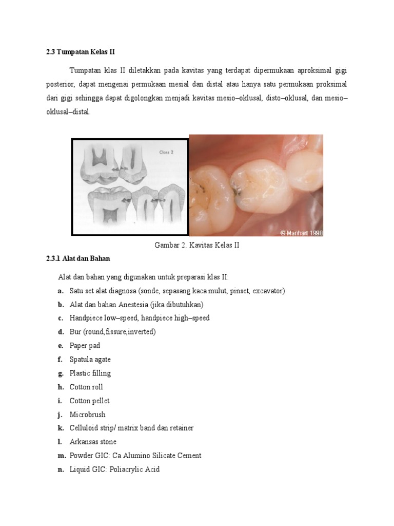 Tumpatan GIC Kelas II | PDF