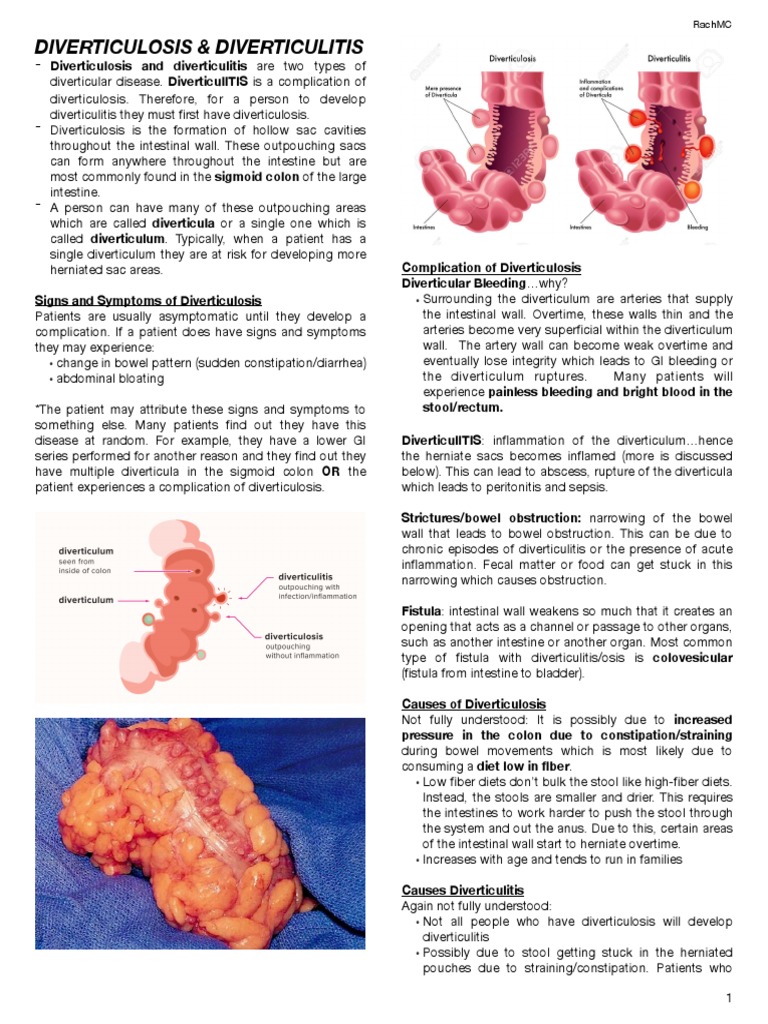 MS Diverticulosis & Diverticulitis | PDF | Gastroenterology | Medical ...