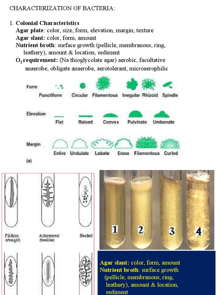 11 Bacteria Characterization | PDF