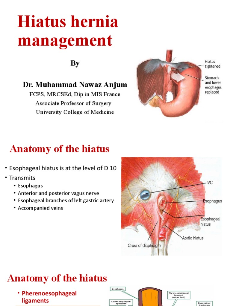 Esophageal Hiatus Anatomy