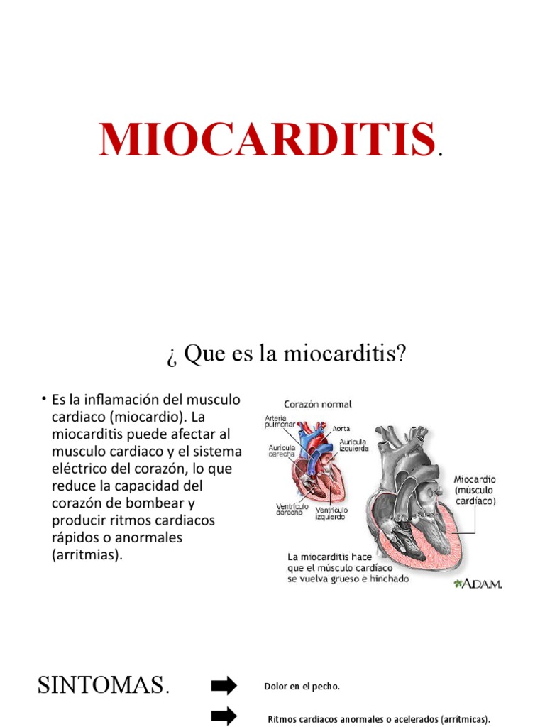 MIOCARDITIS | PDF