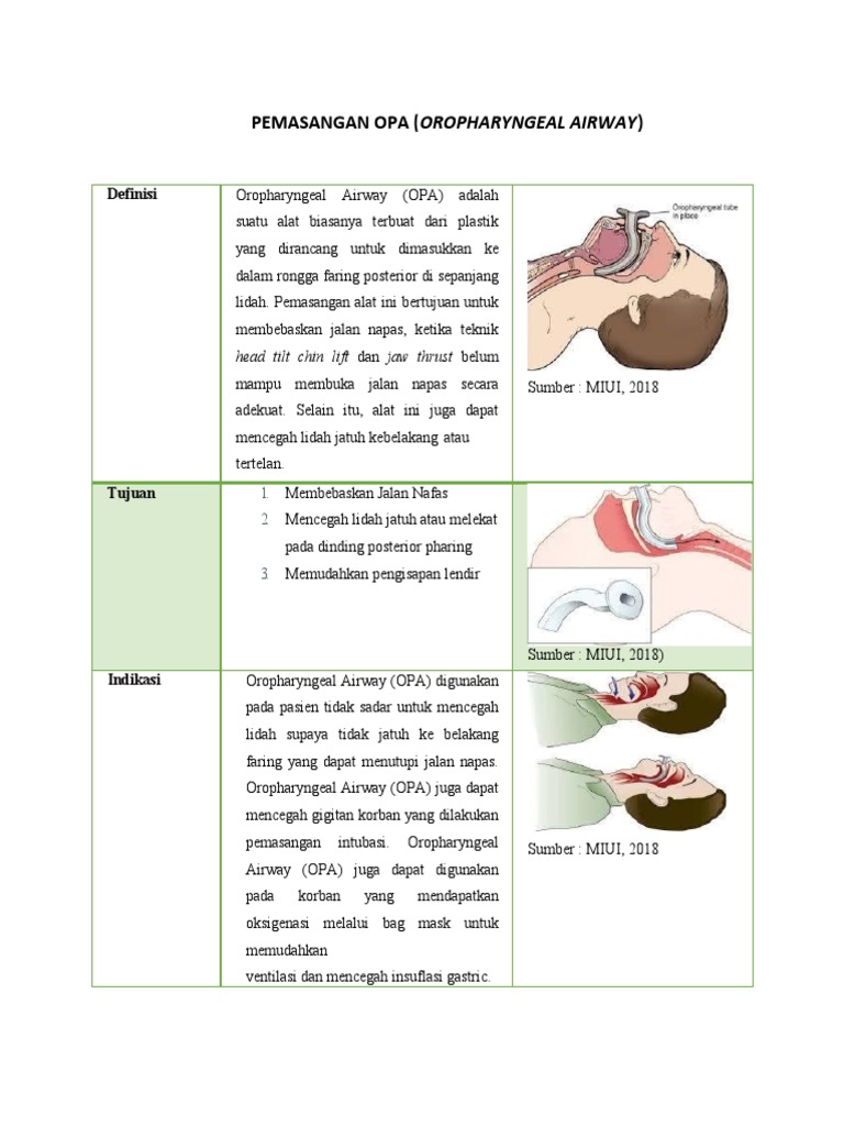SOP OPA Dan NPA | PDF