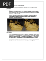 Partes y funciones del paralelígrafo dental | PDF | Dentadura postiza ...