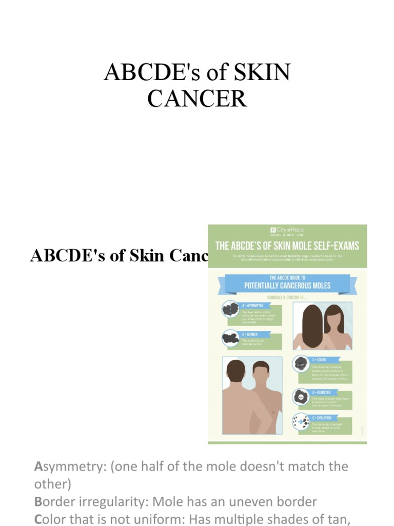 ABCDE's of SKIN CANCER | PDF