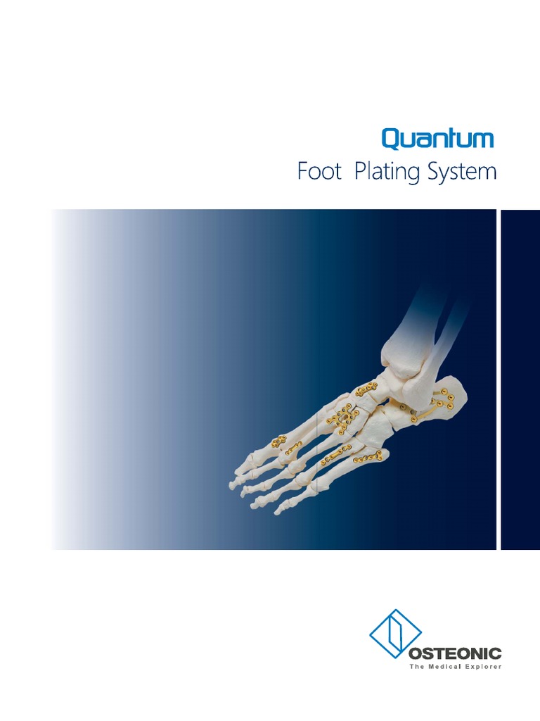 Quantum Foot Plating System | PDF